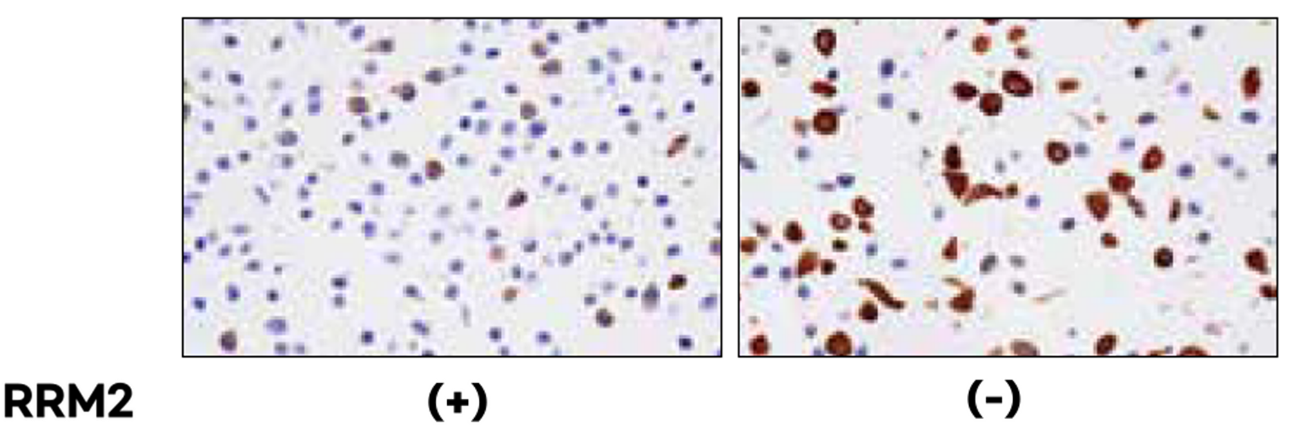 [Cell Signaling Technology] CST Antibody Validation-II - 서린바이오사이언스