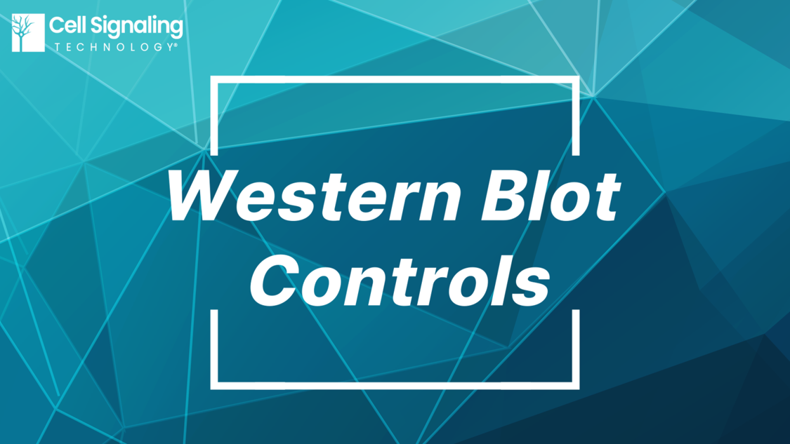 [Cell Signaling Technology] Western Blot Controls - 서린바이오사이언스