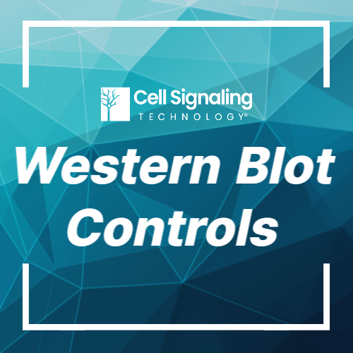 [Cell Signaling Technology] Western Blot Controls - 서린바이오사이언스