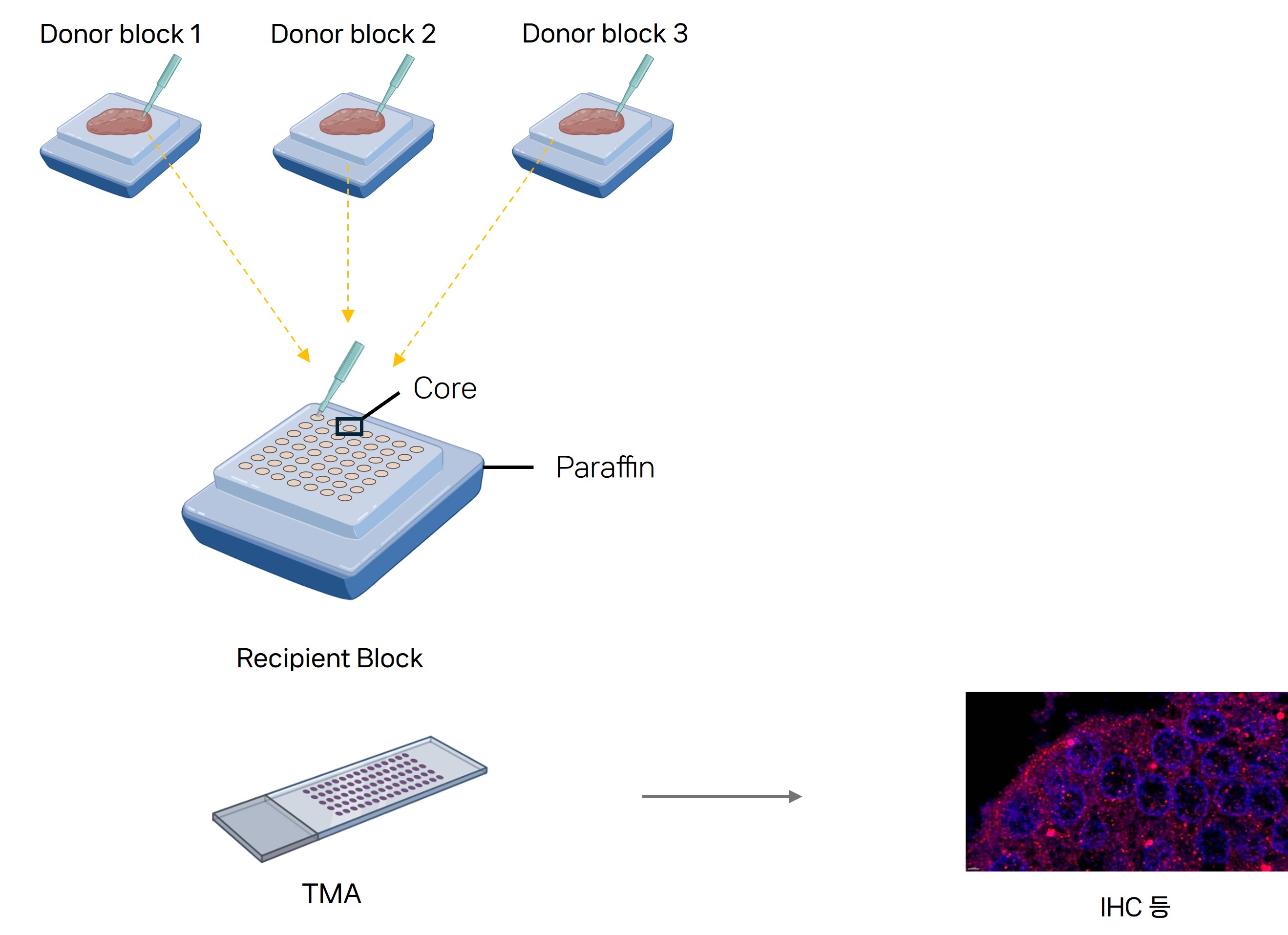[Novus] 고효율 IHC 분석을 위한 스마트한 선택, Novus Tissue Microarray - 서린바이오사이언스